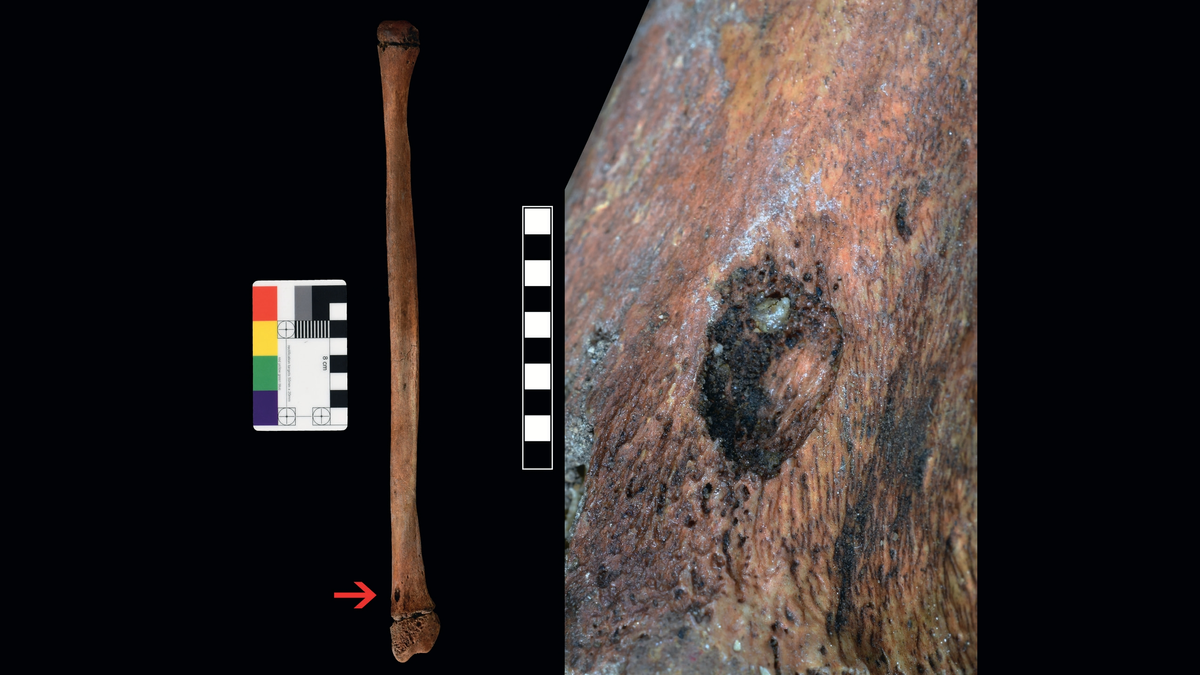 Stone Age teenager was mauled by a bear 28,000 years ago, skeletal ...