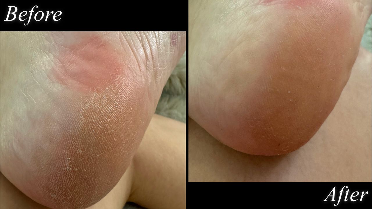 The 12 Best Foot Scrubs for Soft Feet, Tested by Editors | Marie Claire