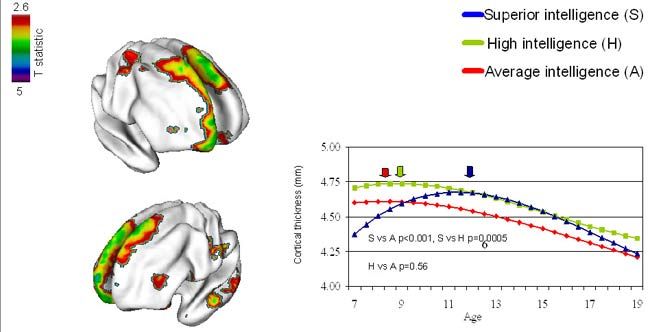 Inside the Brains of Smart Kids | Live Science