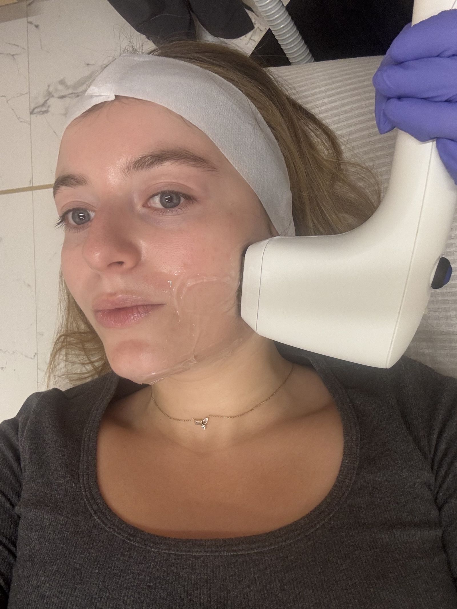 Sofwave Review: My Skin Tightening and Sculpting Results | Marie Claire