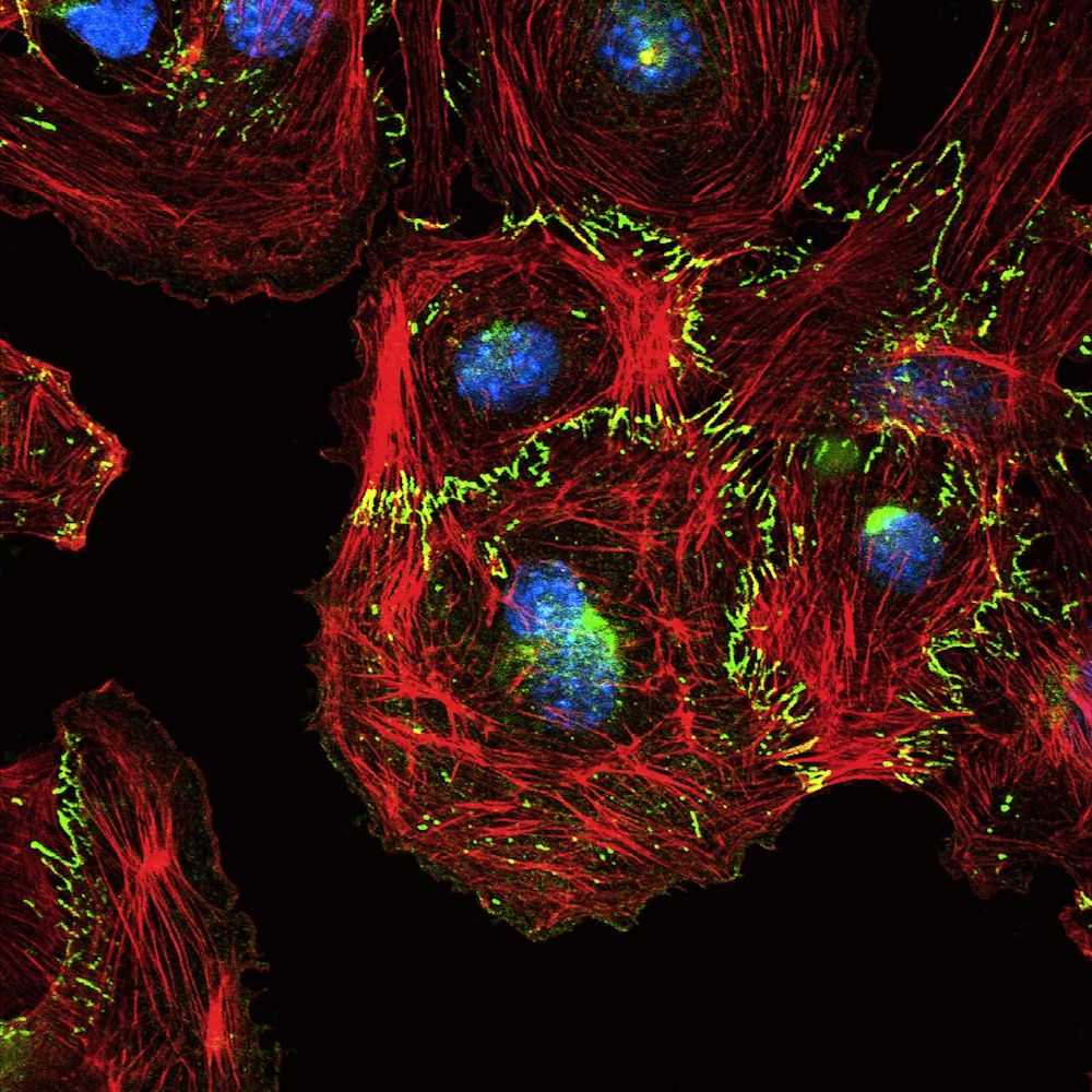 Magnificent Microphotography: 50 Tiny Wonders: Page 3 | Live Science