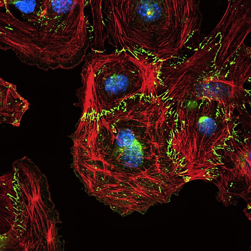 Magnificent Microphotography: 50 Tiny Wonders: Page 3 | Live Science