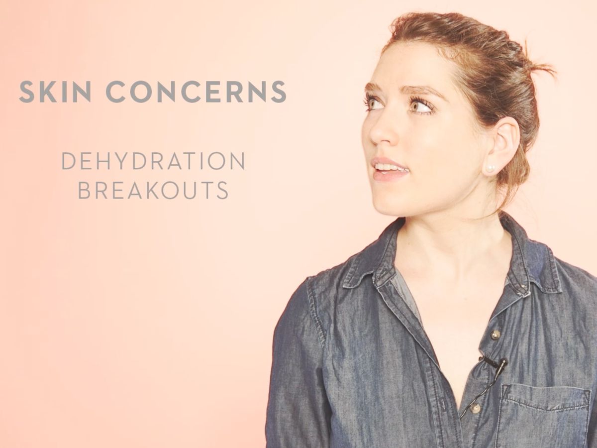Inside our #SOSSkin clinic: how to tackle dehydration | Marie Claire UK
