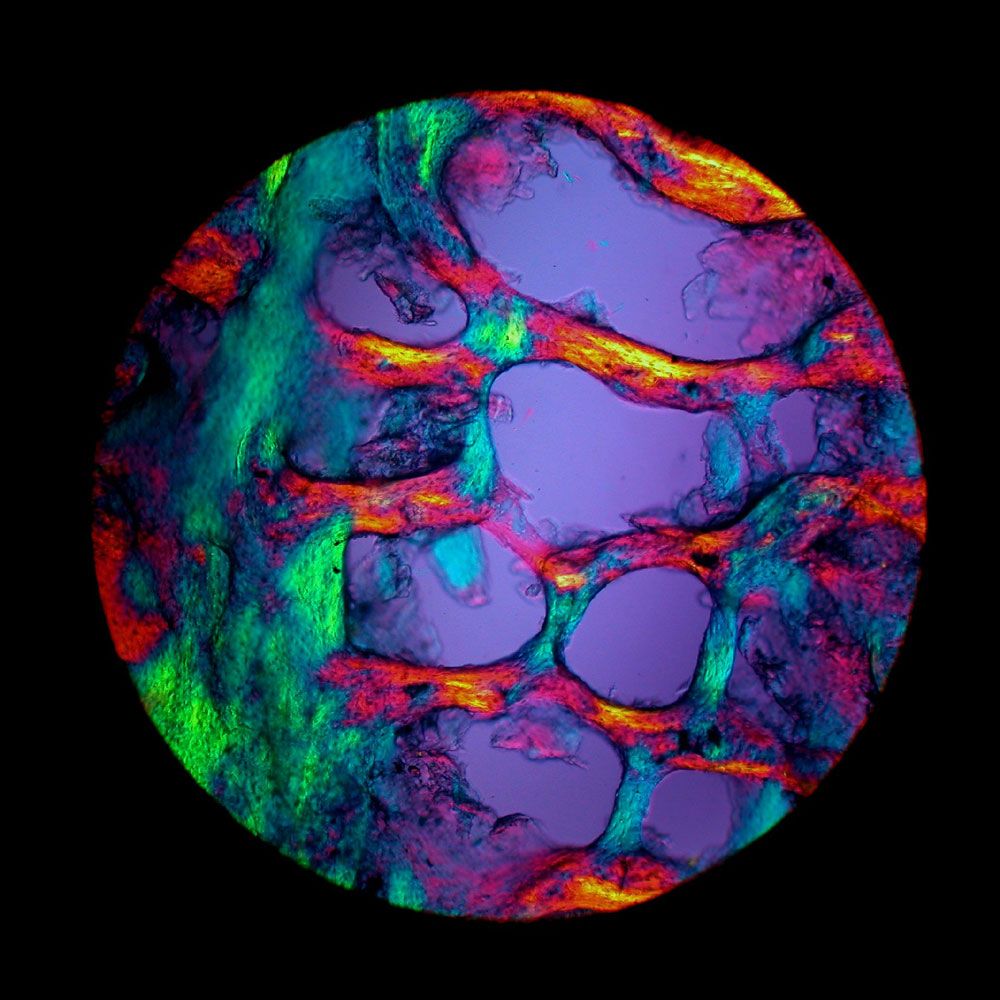 Nature Under Glass: Gallery of Victorian Microscope Slides | Live Science