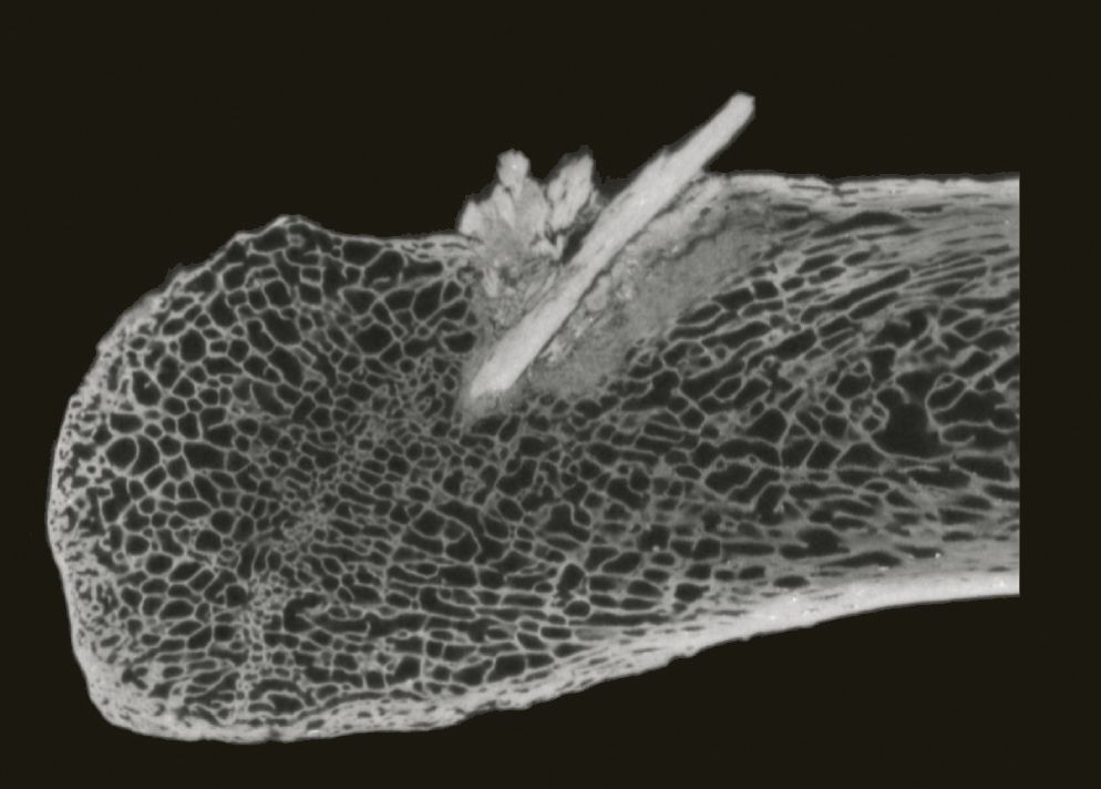 Mastodon Bones: Images of an Early Hunt | Live Science