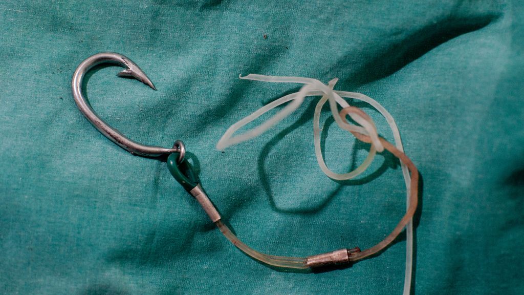 What is the fish hook theory? | The Week