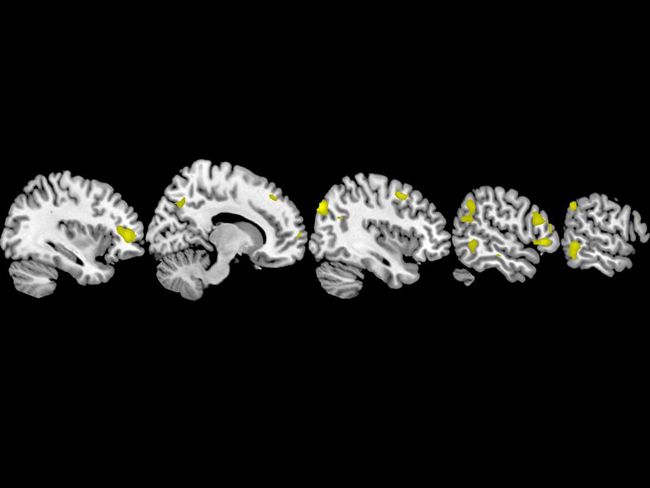 Scientists See God on the Brain | Live Science