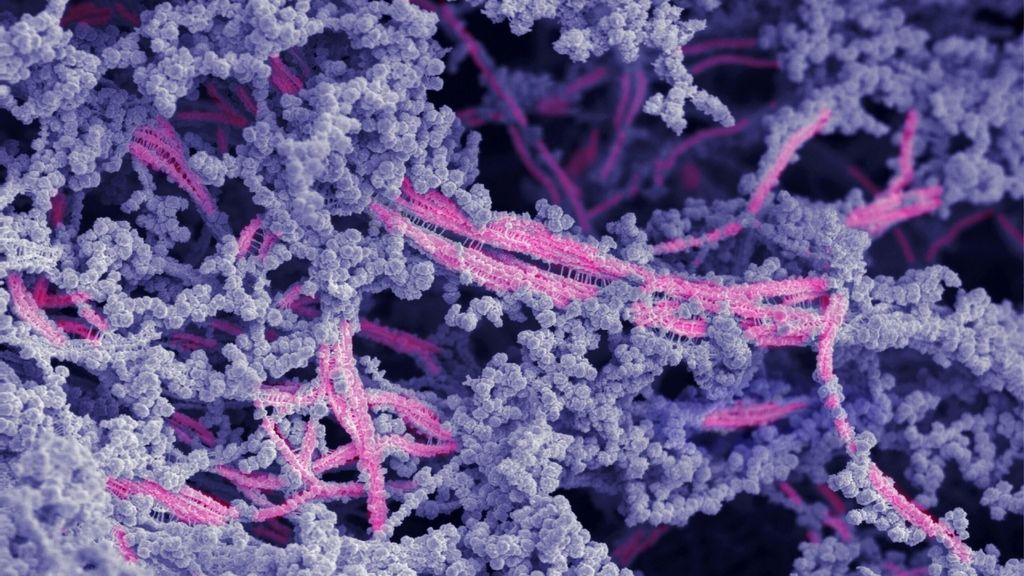 Injectable goo could fix joints without surgery, early study suggests ...