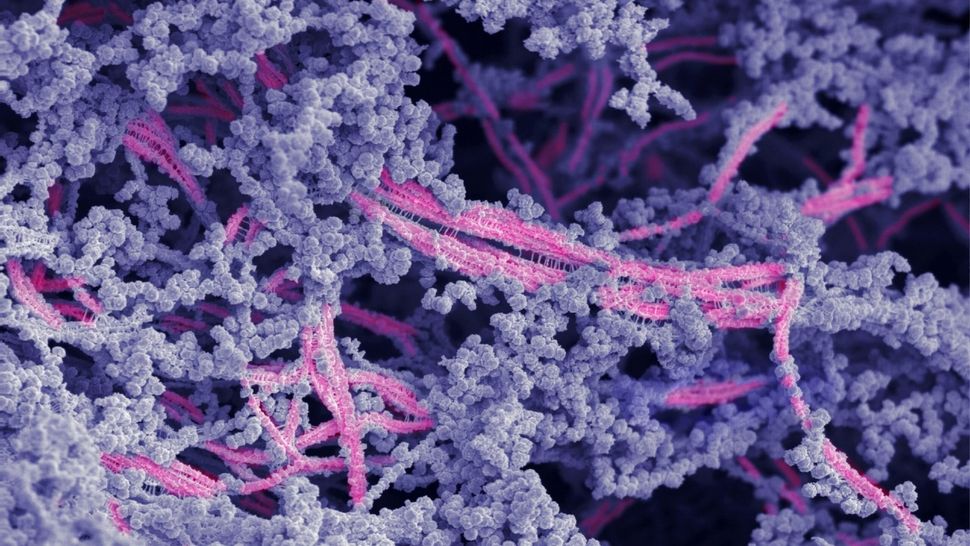 Injectable goo could fix joints without surgery, early study suggests ...