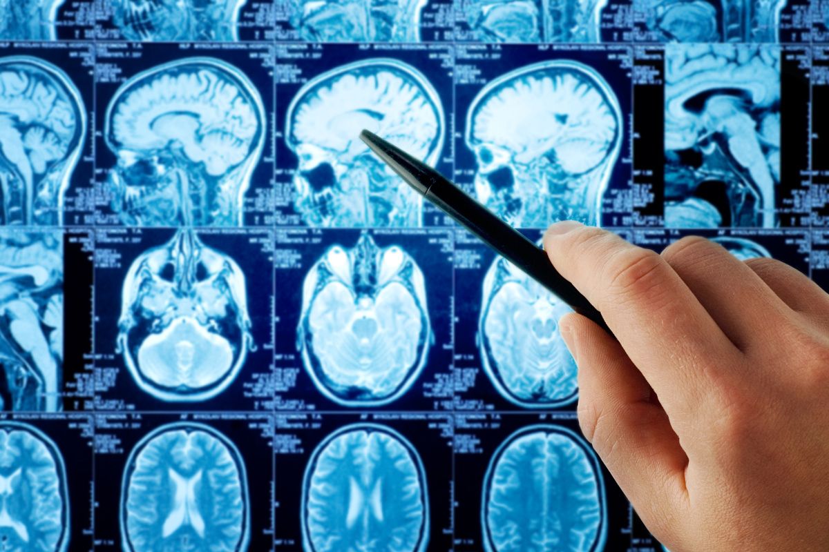 Forget Me Not: History's 17 Most Bizarre Amnesia Cases | Live Science