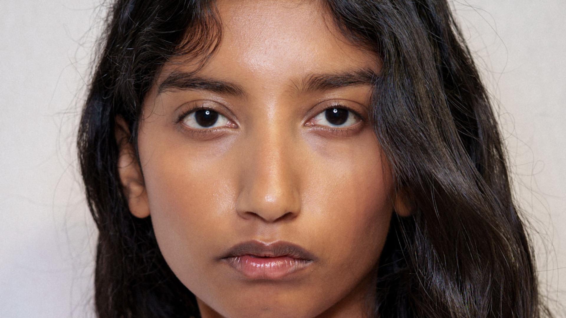 Hormonal Acne: What Causes It And How To Treat It | Marie Claire UK