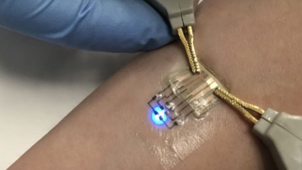 Temporary electronic tattoos could transform healthcare | TechRadar