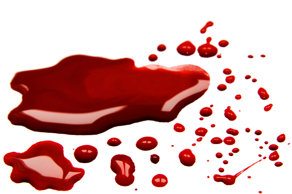 Here s What To Do In A Bleeding Emergency Live Science