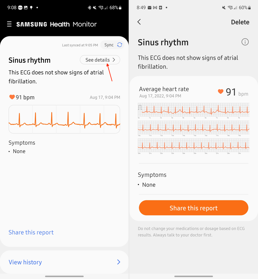 How to monitor your ECG on the Samsung Galaxy Watch 5 | Android Central