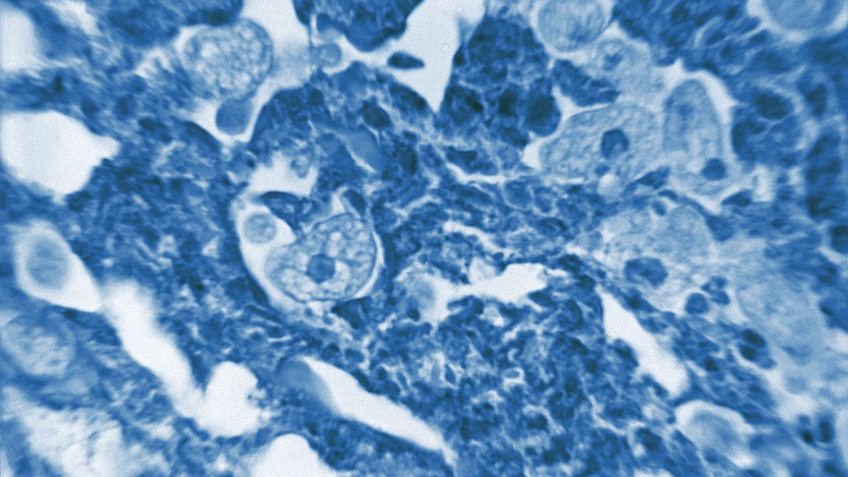 Heart-warming? More like heart-harming. Here are 5 cardiac parasites ...