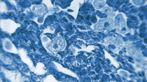 Heart-warming? More like heart-harming. Here are 5 cardiac parasites ...