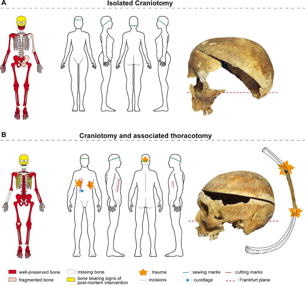 Photos: Renaissance Husband's Heart Buried with Wife | Live Science