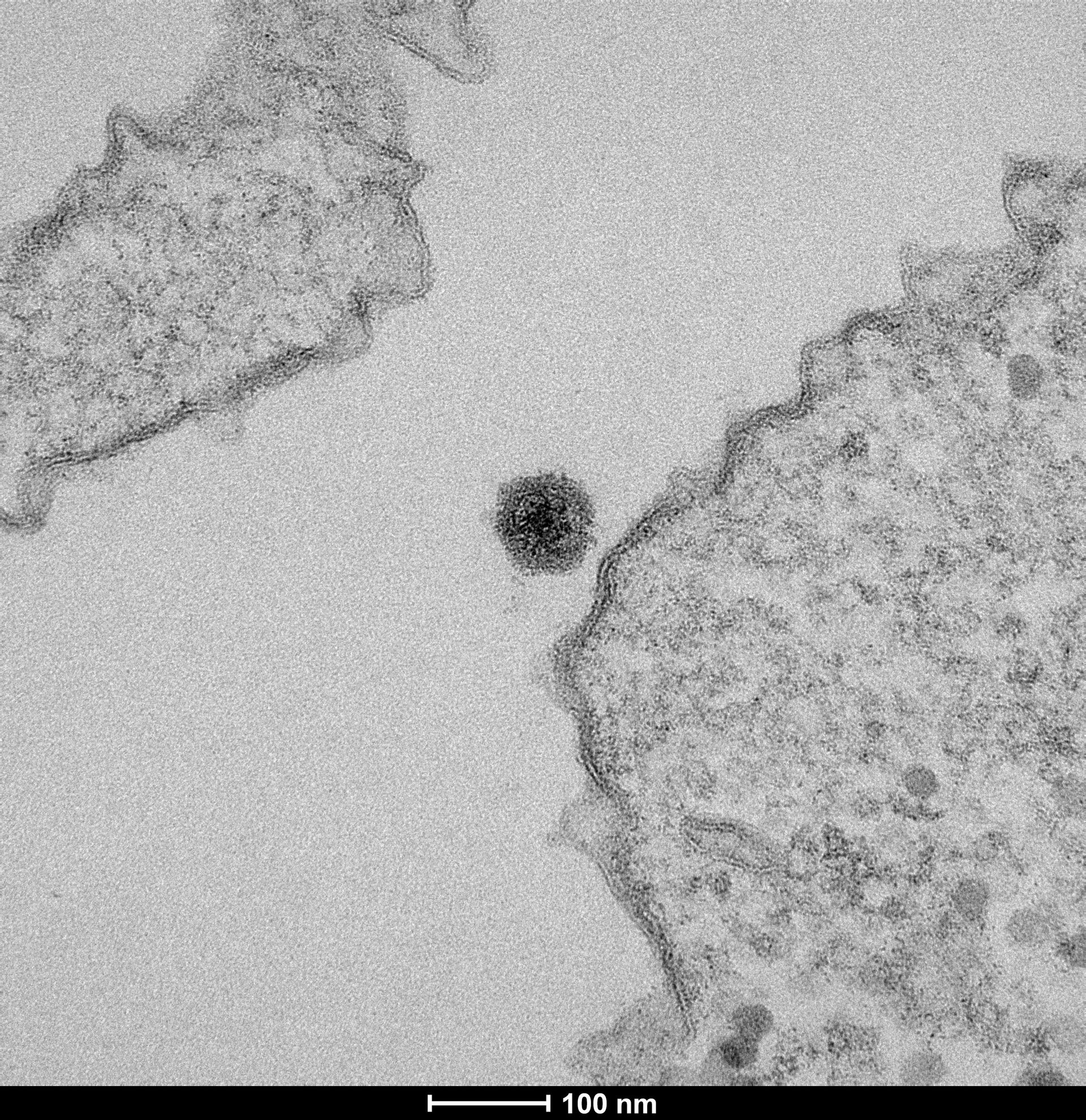 This bizarre virus has genes never seen before | Live Science