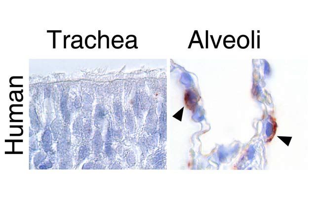 How Bird Flu Infects Humans and Why We Don't Spread It | Live Science