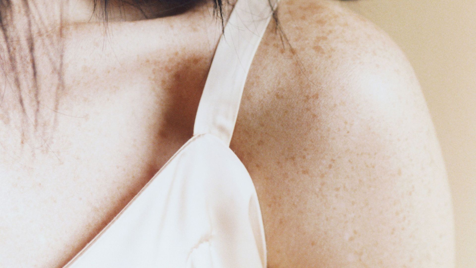 Facts About Freckles - Weird Things About Freckles | Marie Claire
