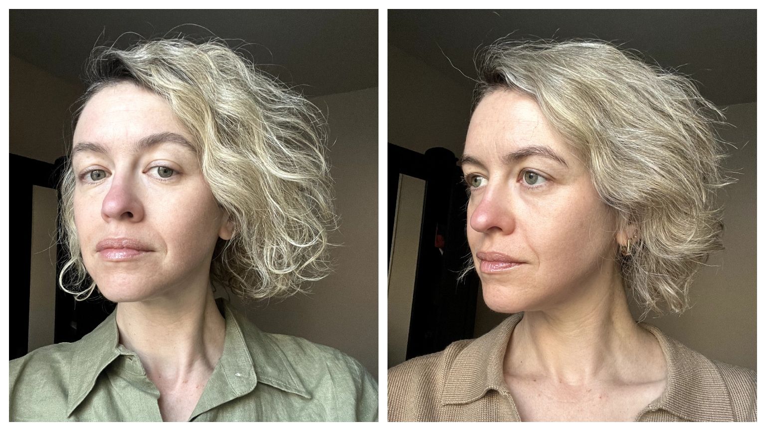 Laser Stacking for Better Skin: I Tried BBL and Halo Treatments | Marie ...