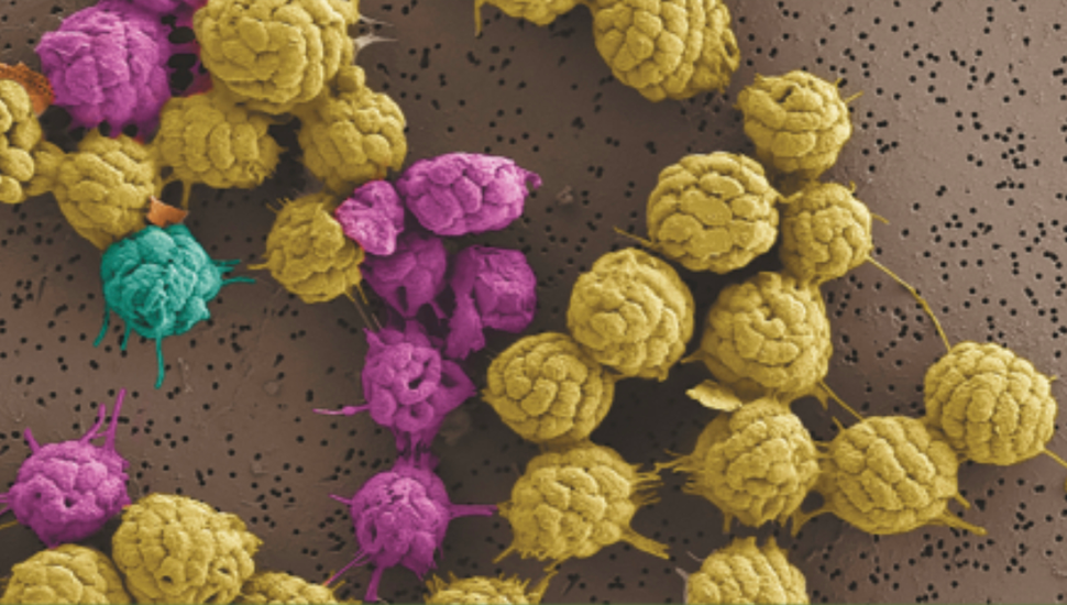 This strange bacteria aligns to Earth's magnetic field and needs ...