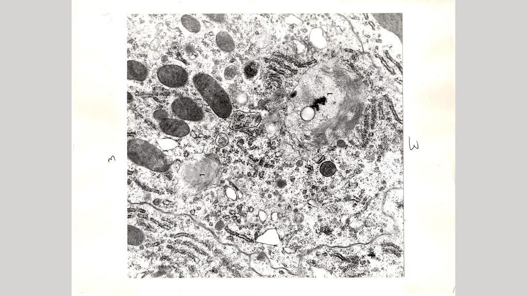 Scientists stumble upon a new part of a cell in one of the most studied ...