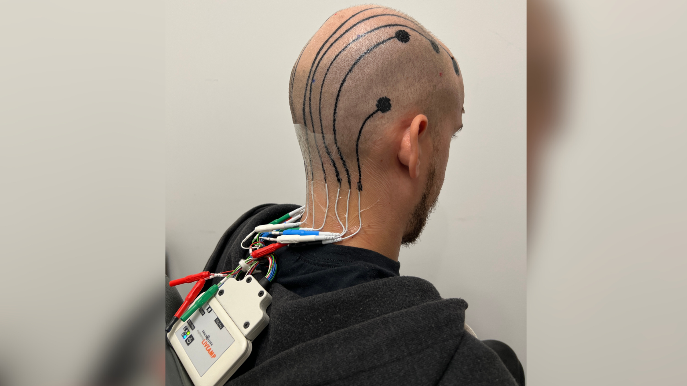 'Electronic' scalp tattoos could be next big thing in brain monitoring ...