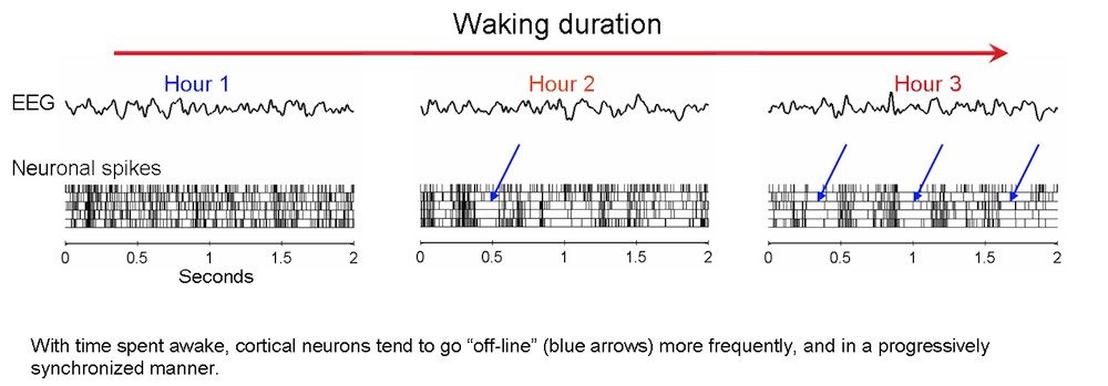 Memory Lapses Linked to Brain Cells Napping | Live Science