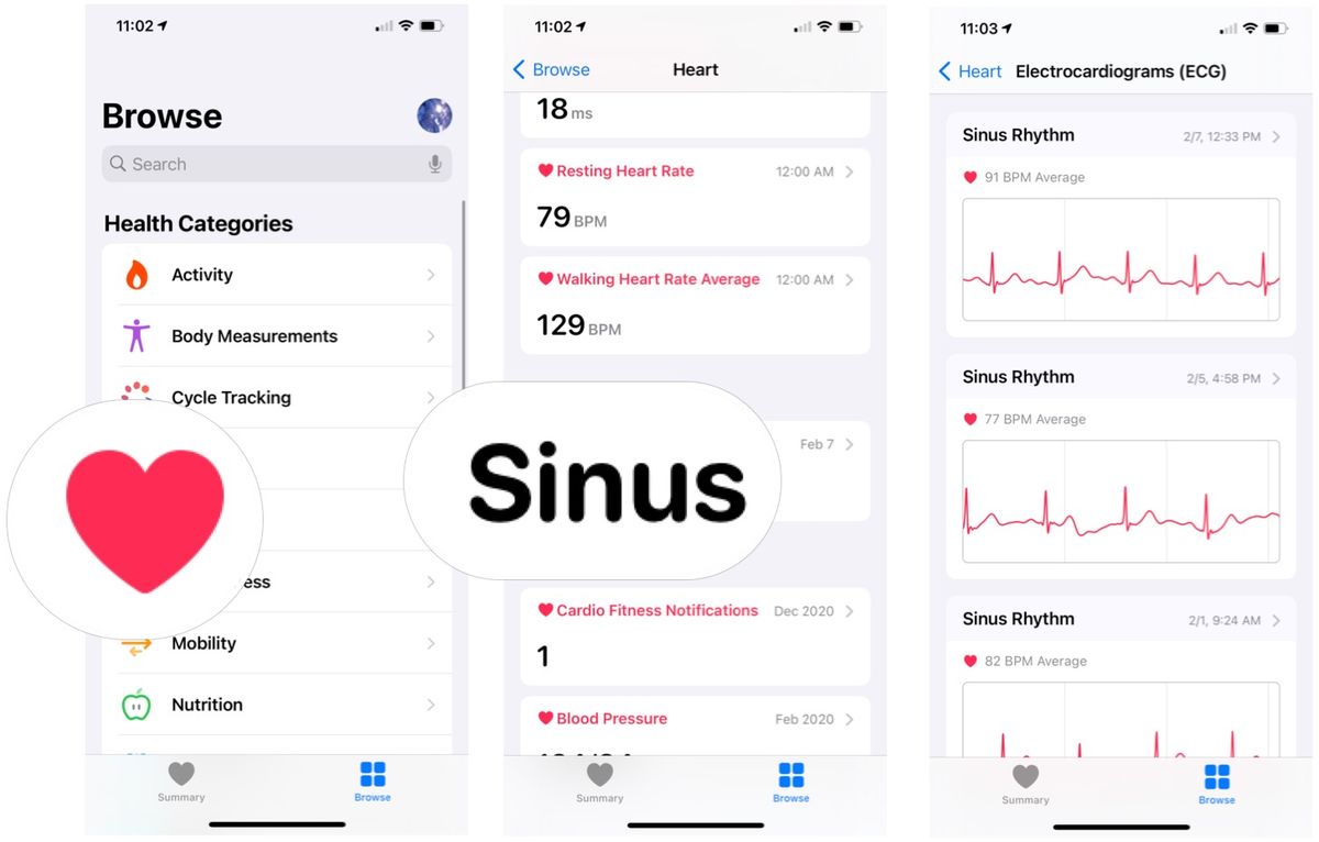 ECG Apple Watch App: The Ultimate Guide | iMore