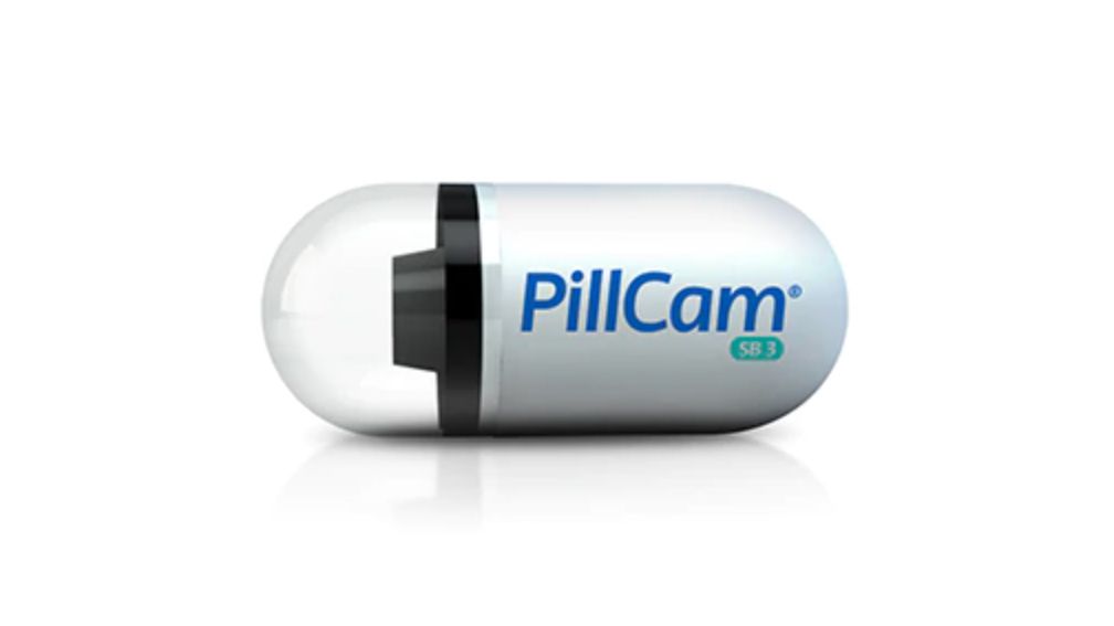 2,000 patients screened for bowel cancer with PillCam, the camera you ...
