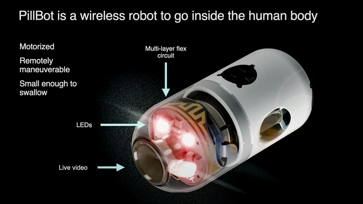 Man swallows camera live on stage to show us the insides of his stomach ...