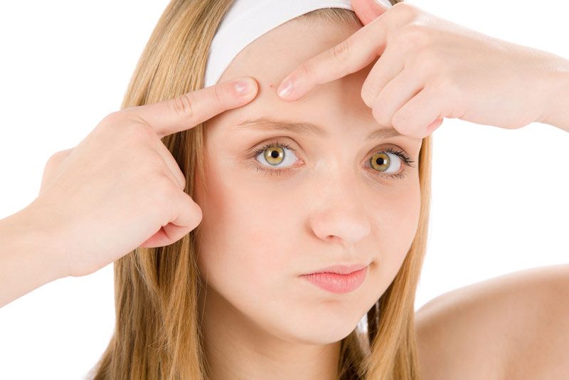 Why Some People Get Zits And Others Don't | Live Science