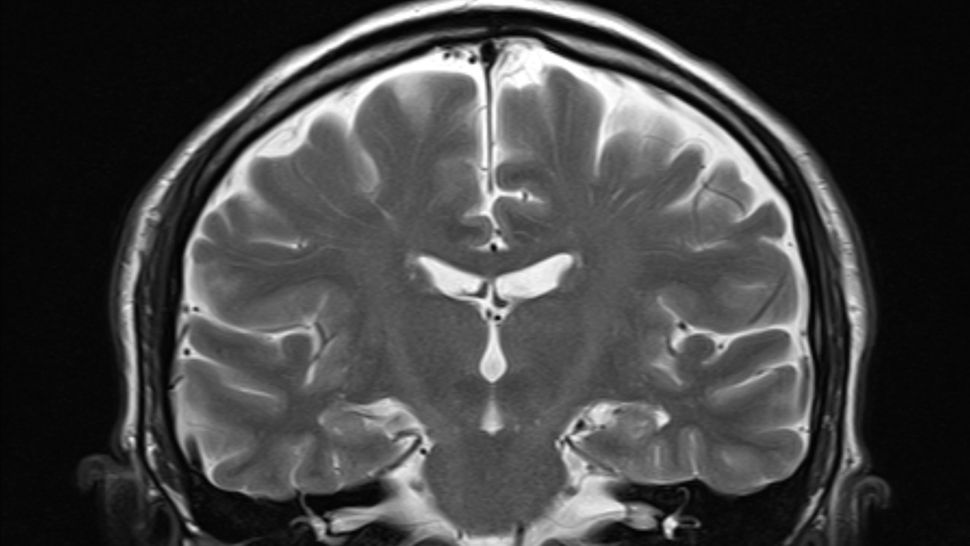 A single MRI can reveal how quickly you're aging, scientists claim ...