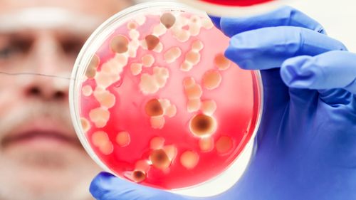 Just 2 Labs in the World House Smallpox. The One in Russia Had an ...