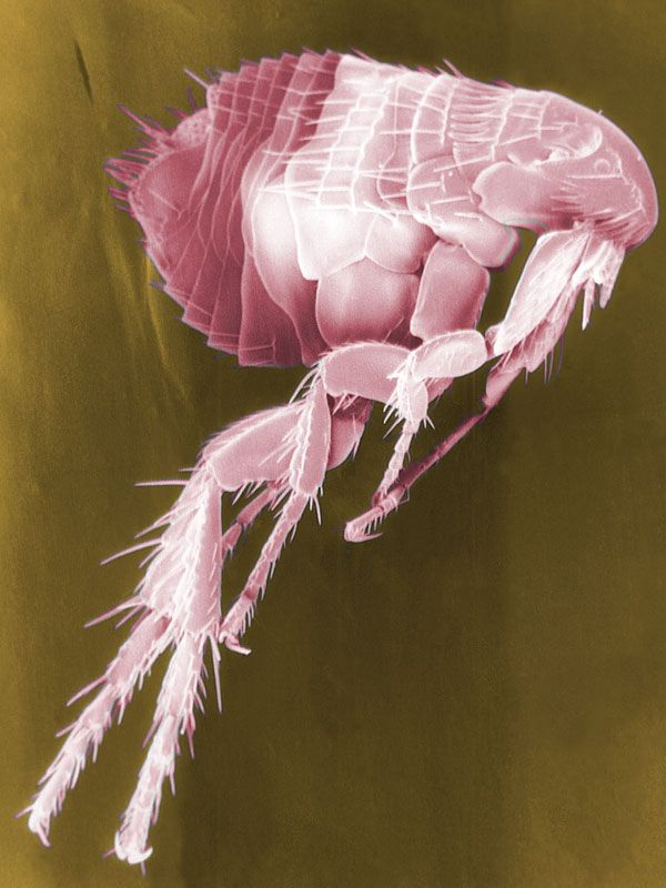 Pictures of a killer: A plague gallery | Live Science