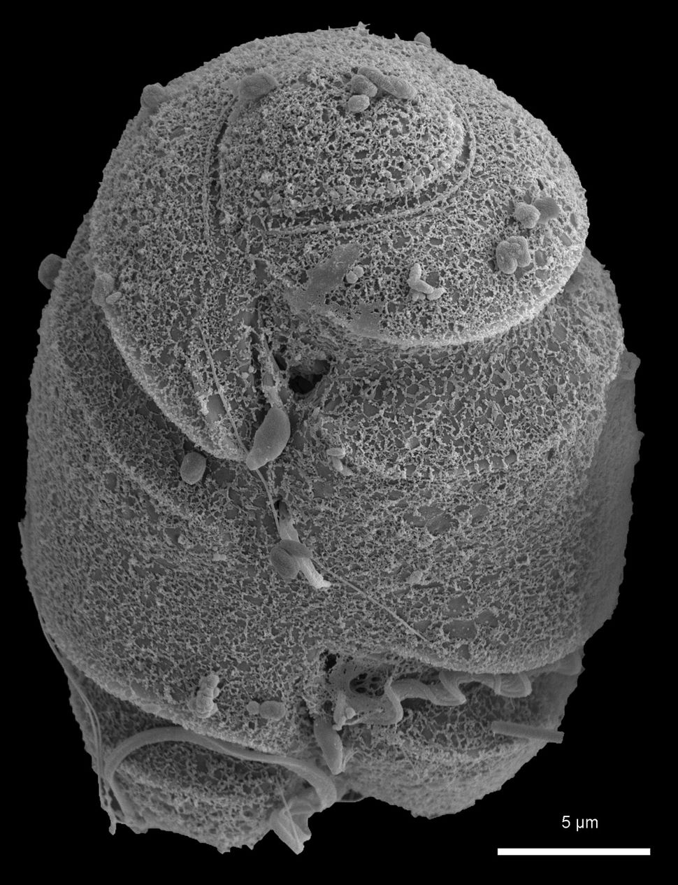 In Photos: Tiny Plankton Show Off Advanced Weaponry | Live Science