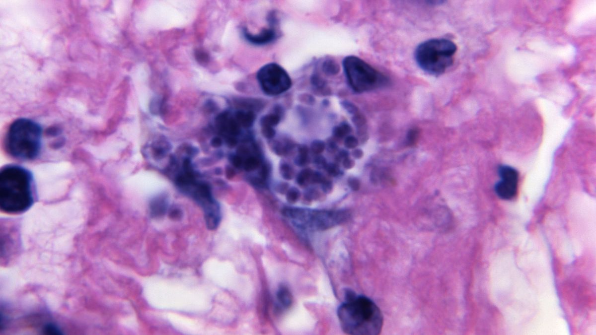 Heart-warming? More like heart-harming. Here are 5 cardiac parasites ...