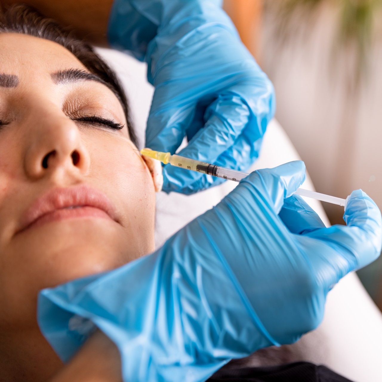 What to Know Before Getting Facial Fillers, According to Dermatologists ...