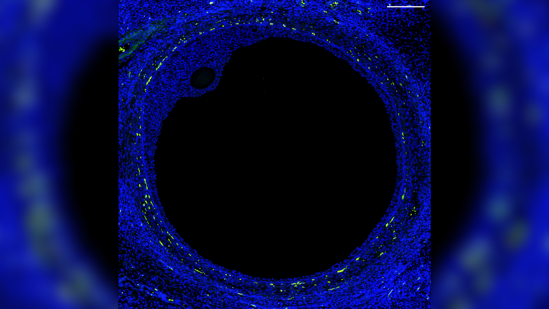 1st 'atlas' of human ovaries could lead to fertility breakthrough ...