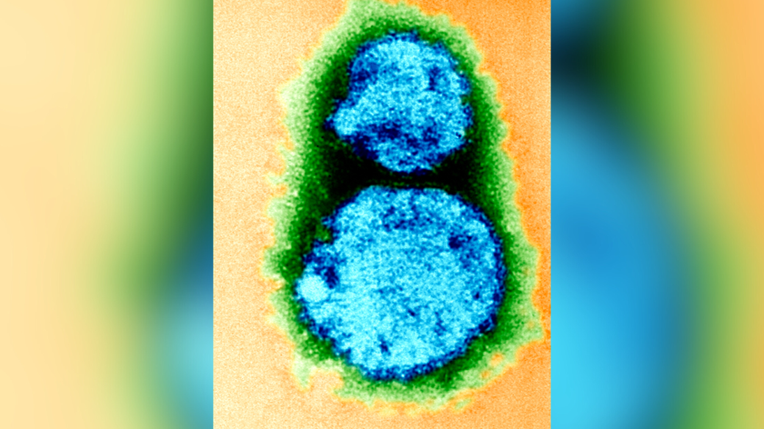 Virus News - Viral Diseases in Humans, Animals | Live Science