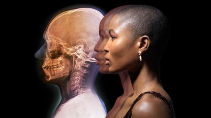 Bone Density and Face Aging: What Dermatologists Want You to Know ...