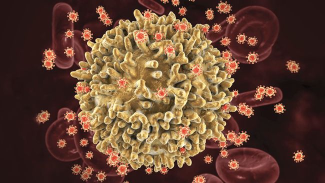A 'functional cure' for HIV may be in reach, early trials suggest ...