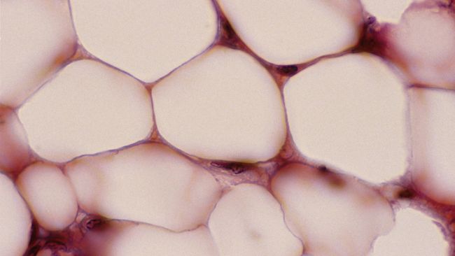 Fat cells have a 'memory' of obesity, study finds | Live Science
