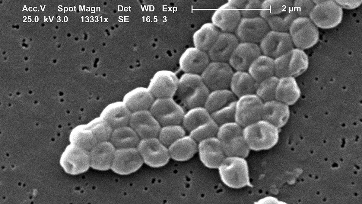 NASA may have unknowingly found and killed alien life on Mars 50 years ...