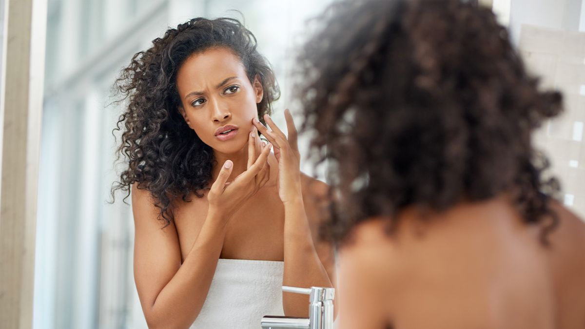 How to pop a pimple the right way | My Imperfect Life