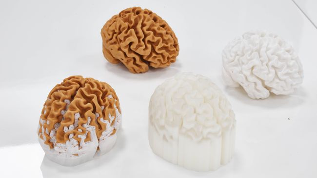 3D-printed models of the brain will help people understand dementia ...
