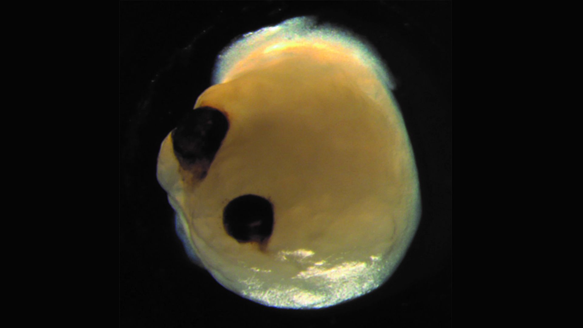 Lab-made mini brains grow their own sets of 'eyes' | Live Science