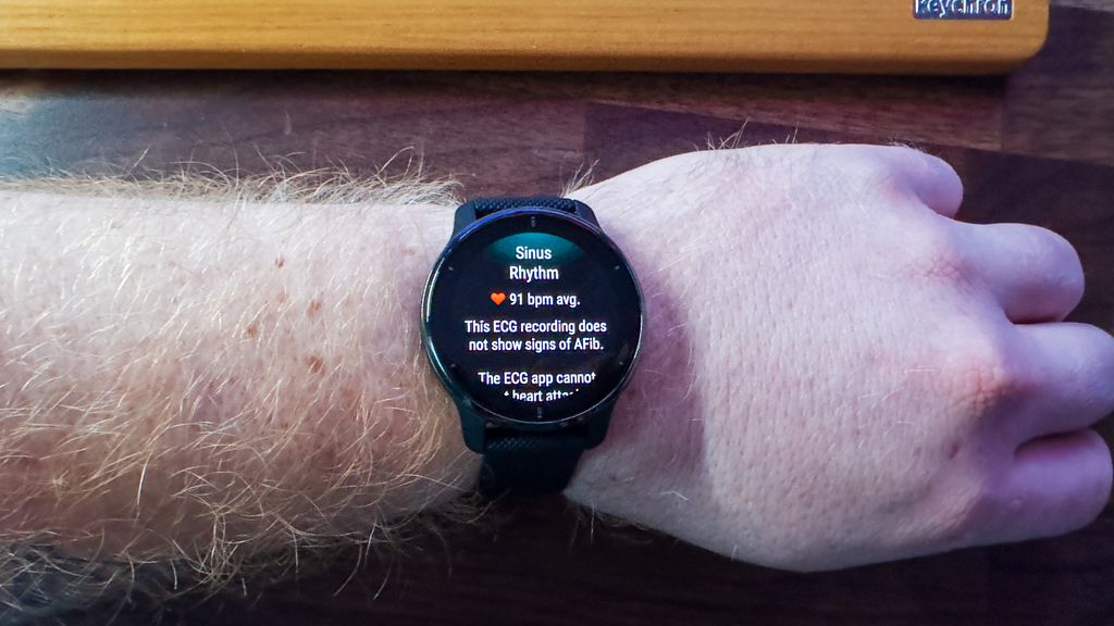 How to use the Garmin ECG app | Android Central
