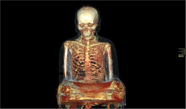 Surprise! Buddha Statue Hides Mummified Remains | Live Science